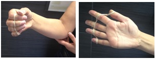 Manual PT Versus CTS Surgery – Advanced Physical Therapy Education ...